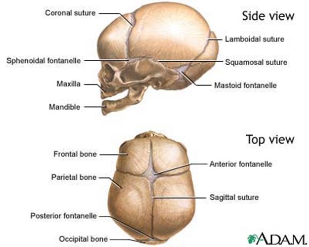 What Is Craniosynostosis 