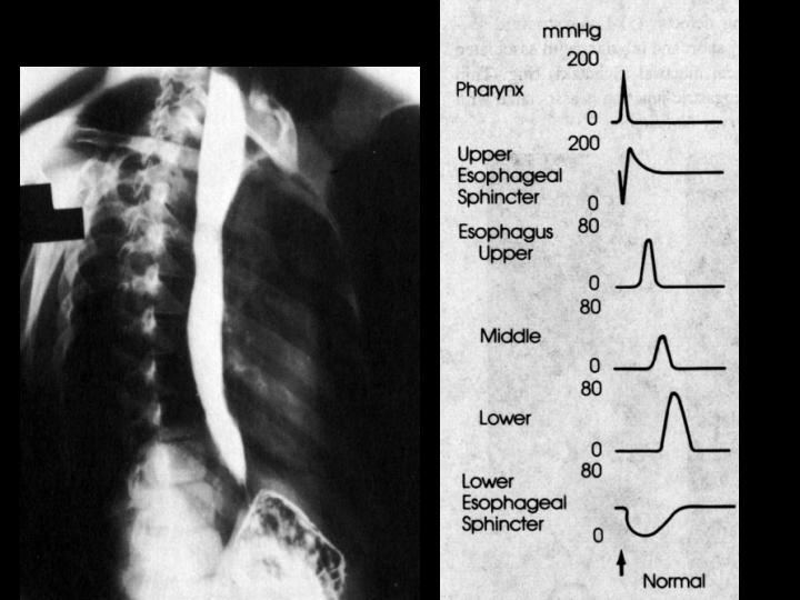 ÑAJDSFÑKJASDÑFKJADSÑFJ